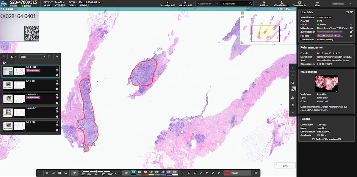 Indica Labs digital pathology platform chosen by the Institute of Tissue Medicine to transform ...